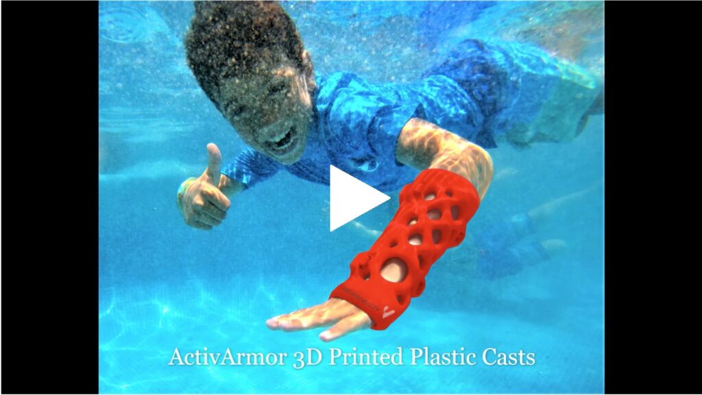 ActivArmor Is Making the Future of Orthopedic Casts - Kingscrowd