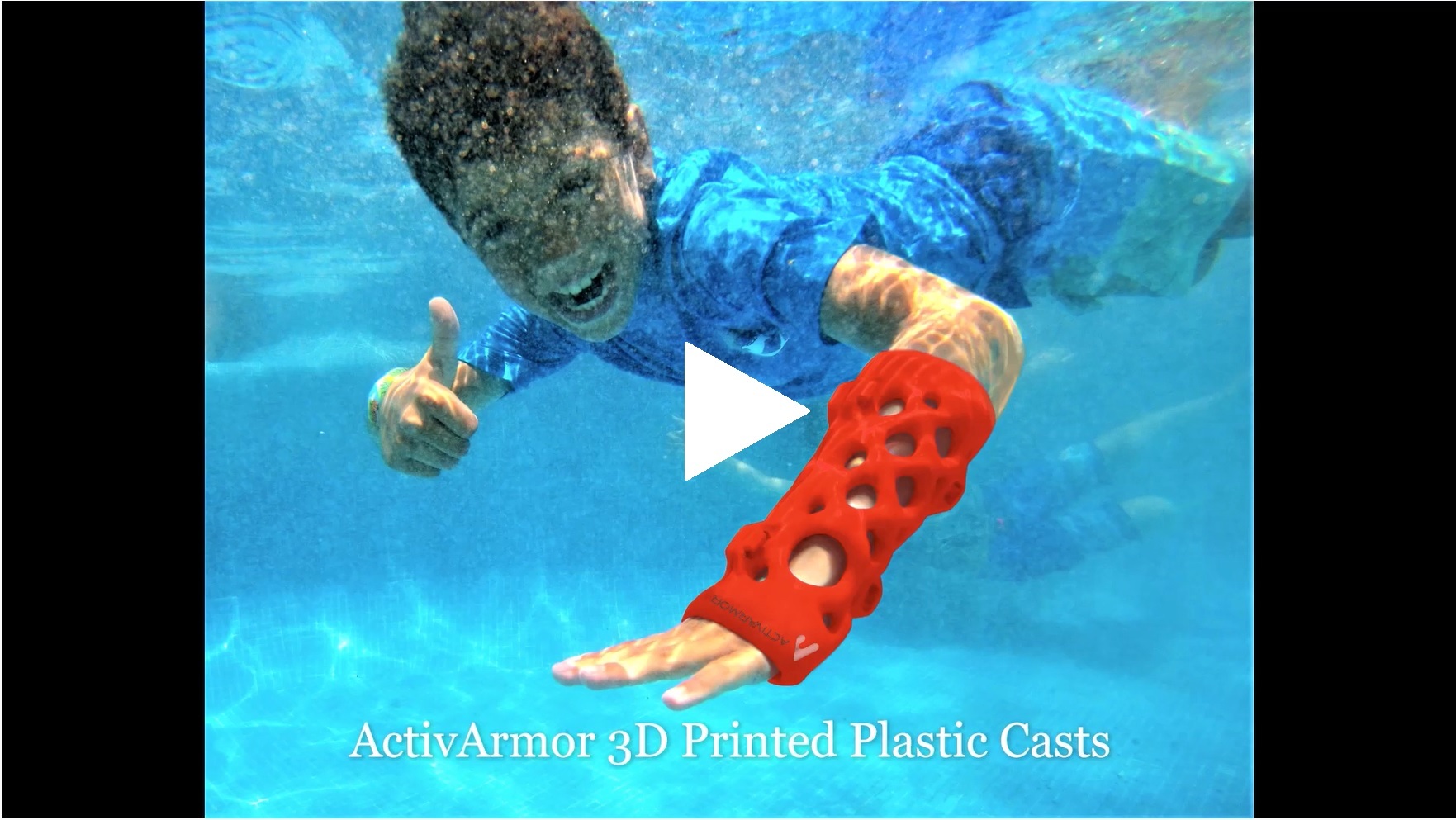 ActivArmor Is Making the Future of Orthopedic Casts - Kingscrowd